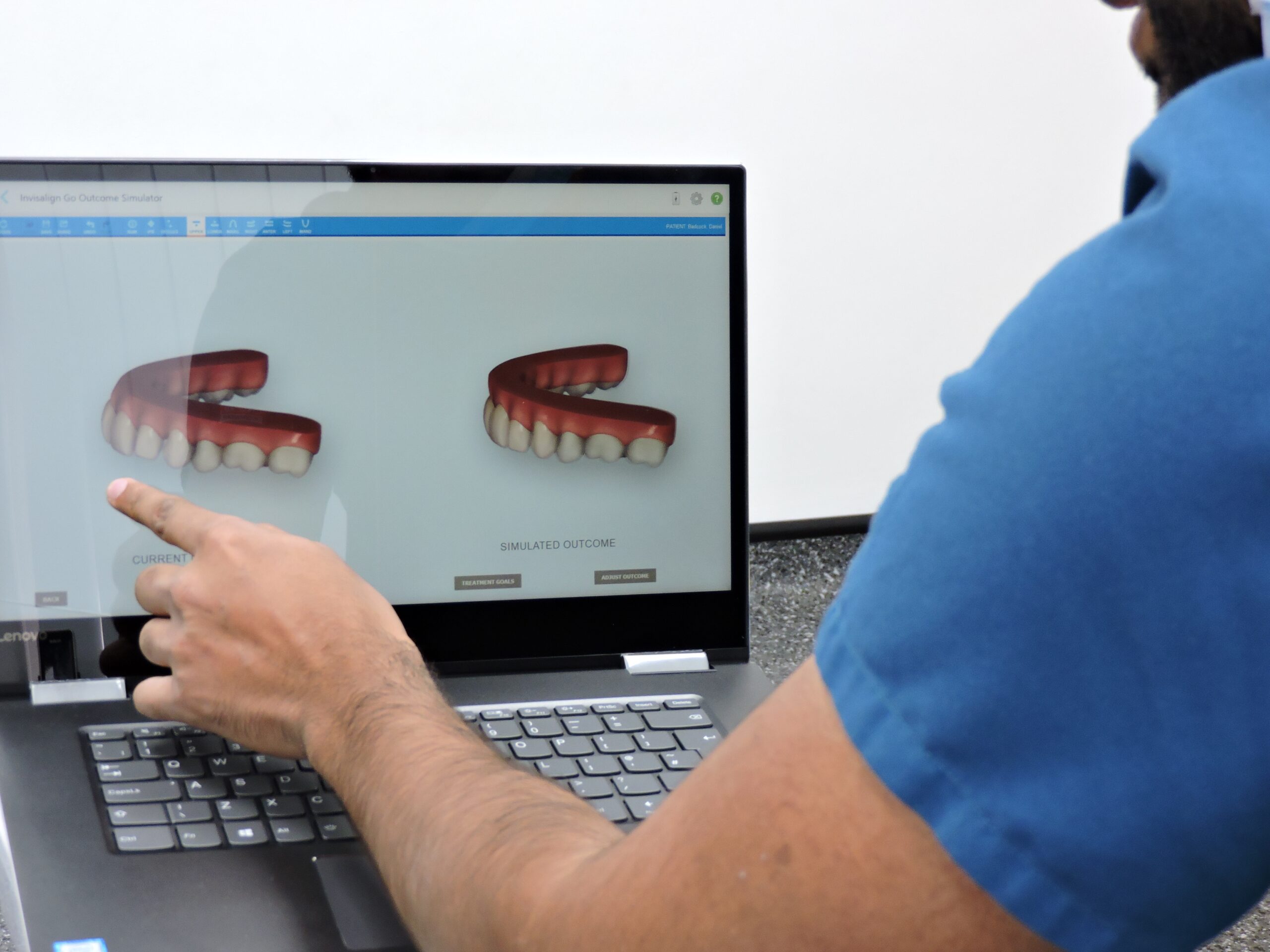 I-Tero Scanner - A&U Dental - S m i ) e... it's a Vibe!